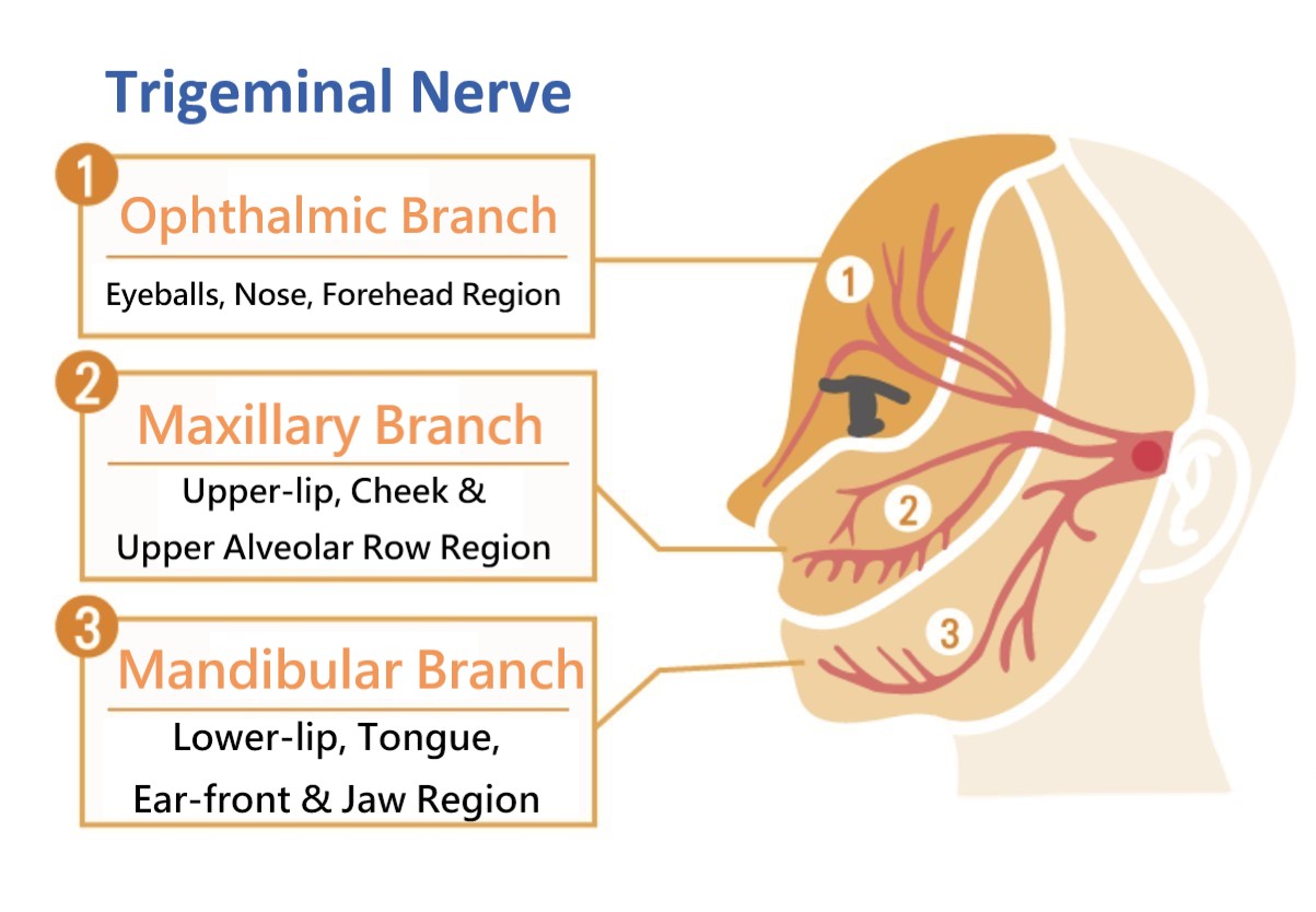 Trigeminal Neuralgia - Introduction and Treatment Overview – THE HONG ...