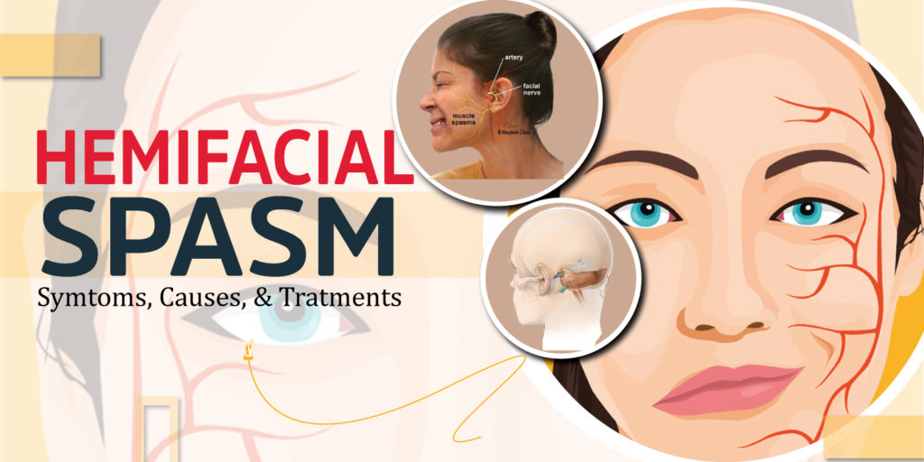 Hemifacial Spasm - Unusual Eye Twitching–