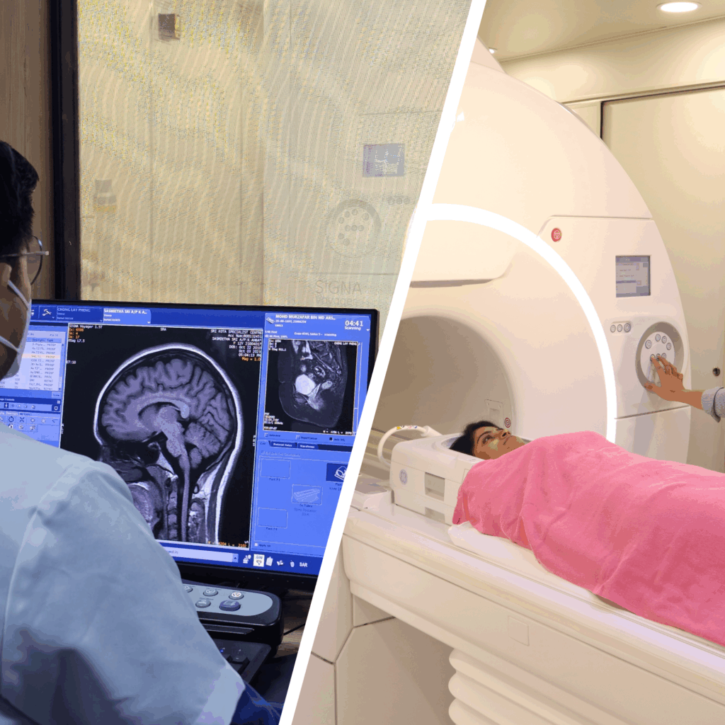 Recognize Stroke Symptoms and 24 Hours Emergency Stroke MRI ...